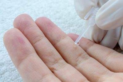 Verruche sulle mani: come trattarle e come evitare il contagio